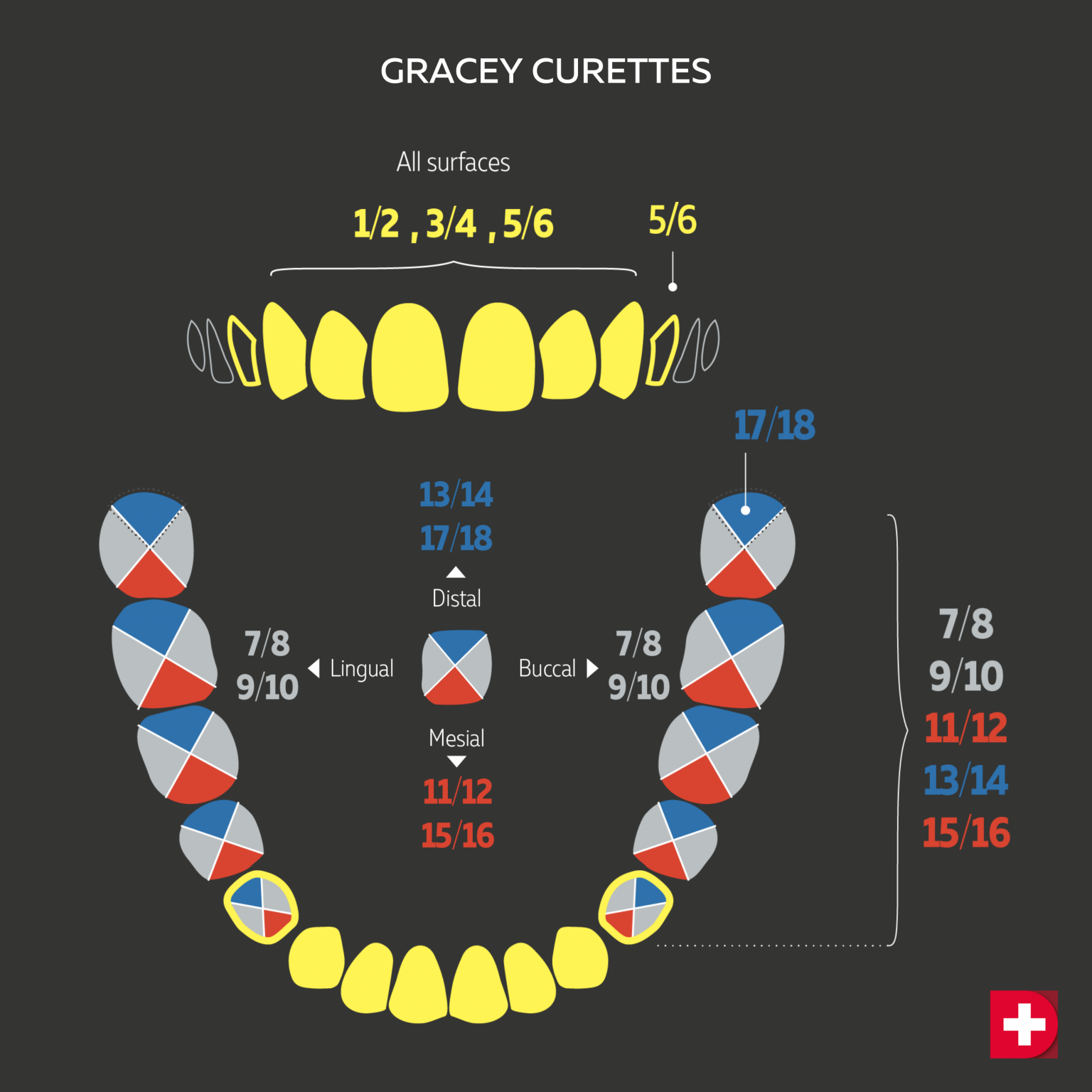 Periodontal Curettes Focus On Gracey Curettes Dental Hand Instruments periodontal-curettes-focus-on-gracey-curettes-dental-hand-instruments